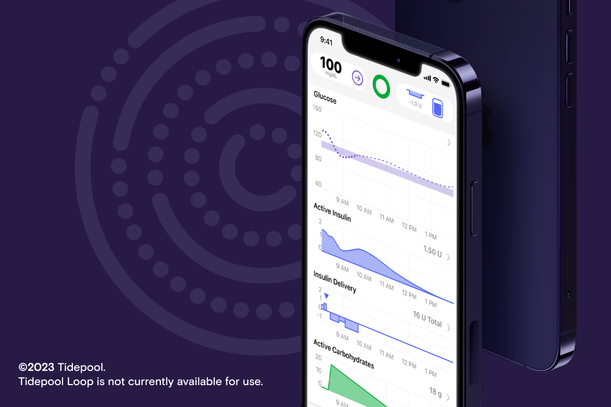 Tidepool Loop features